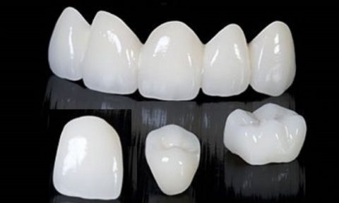 Zirconia Crown & E-Max Crown - Dental Crown in Albania